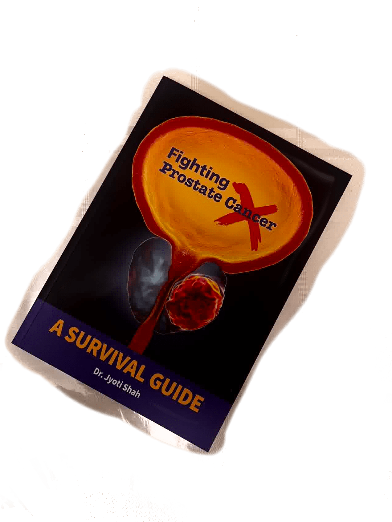 Fighting Prostate Cancer | Inspire Health